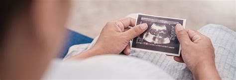 초음파 4d 스캔 이미지를 보유한 아시아 또는 백인 임산부 아동 및 산전 관리의 기대 부모 유대감 여성 임신 개념 배너 초음파에 대한 스톡 사진 및 기타 이미지 Istock