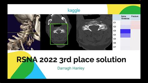 Kaggle Rsna 2022 C Spine Fracture Detection Ai Challenge 3rd Place Solution Youtube