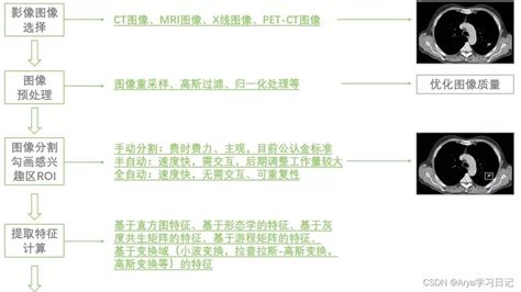 医学影像知识（二）：医学影像常见数据预处理方式医学图像预处理 Csdn博客