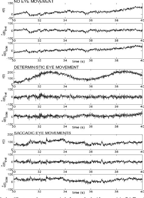 Figure 4 From Using An Eye Tracker For Accurate Eye Movement Artifact