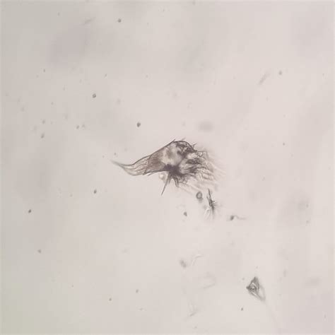 Found A Flood Spore In My Microbiology Class R Halo