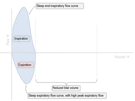 Interpreting The Shape Of The Flow Volume Loop Deranged Physiology