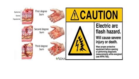 Understanding Arc Flash Injuries And Standards Kavin Kumar G Posted