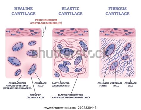 Hyaline Cartilage Slide Labeled