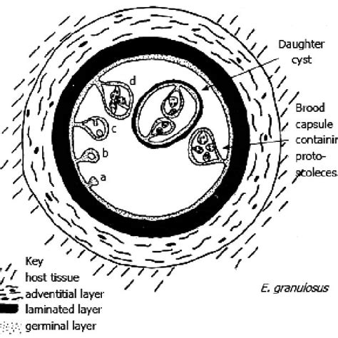 Suggested Treatment Algorithm For Echinococcus Granulosus Infection Download Scientific