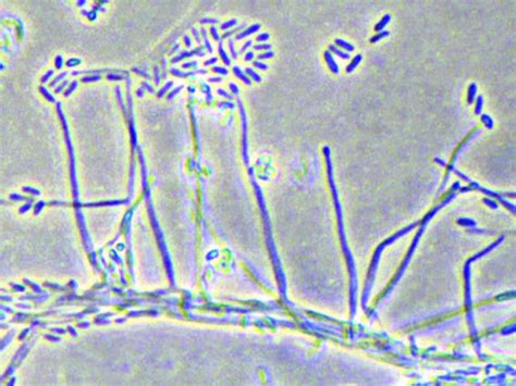Acremonium Mycology University Of Adelaide