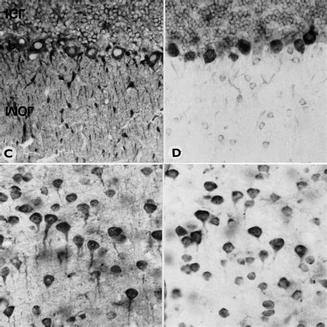 Differential Staining Of Cerebral Cortex At Layer V A B And Of