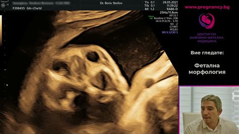 Фетална морфология при д р Борис Стоилов Youtube