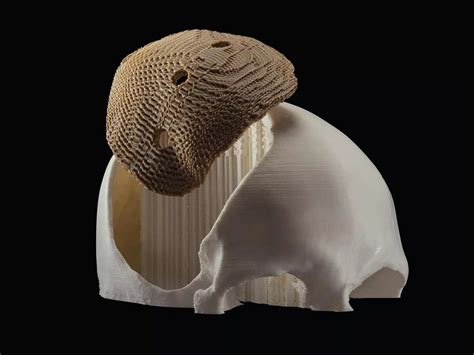 Plastic Material Polyether Ether Ketone Peek Beyond Bynd