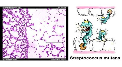 Biochemical Test And Identification Of Streptococcus Mutans
