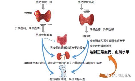 科普当甲状旁腺激素遇上终末期肾病，好心帮倒忙继发性