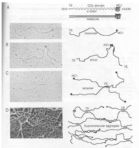 Alport Syndrome Flashcards Quizlet