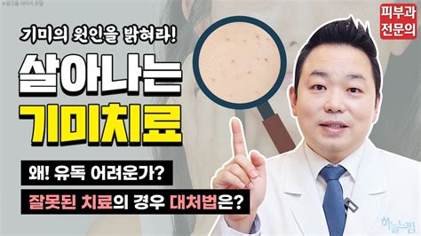 기미 치료 후 쉽게 발생하는 부작용 대처하는 방법이 궁금하다면 Youtube