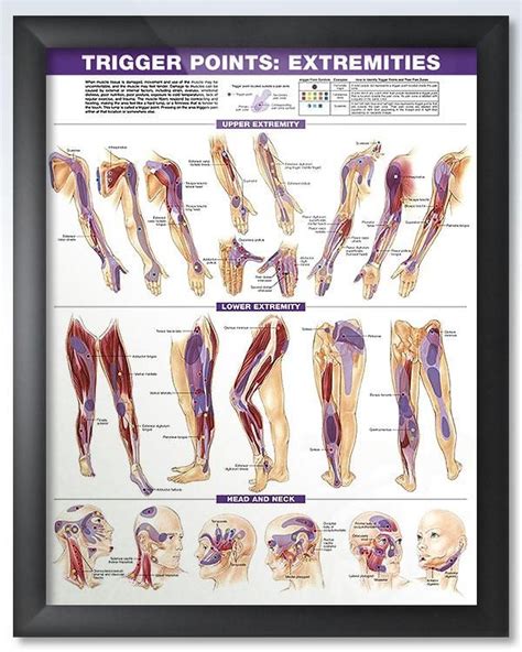 Trigger Point Charts Chart Set Artofit