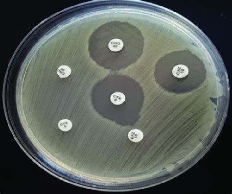 Phenotypic Detection Of Esbl Producing Organisms With The Combined Disk