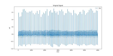 Github Ufthaqbpm Ecg Pan Tomkins Algorithm Python How To Get Heart