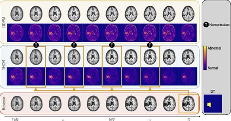 Diffusion Models With Implicit Guidance For Medical Anomaly Detection Paper And Code