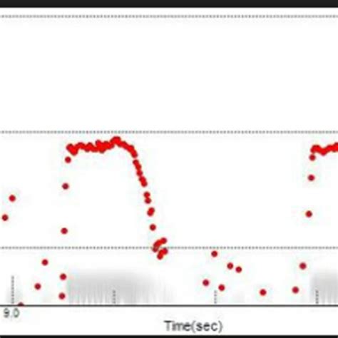Acoustic Analysis After Recording With An Electronic Stethoscope Using Download Scientific