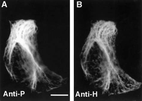 Coexpression Of Peripherin With Two Neurofilament Subunits In