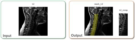 Spinalcordtoolboxdocumentationsourceusersectiontutorials