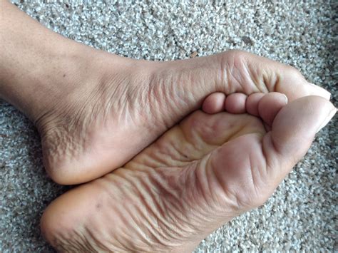 Wrinkled Soles Im The Morning R Wrinkledsoles