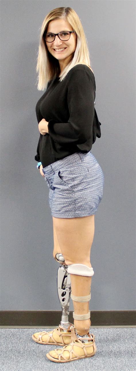 Female Amputees For Sale Hannah The Body Positive Quadruple Amputee