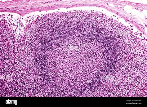 Cross Section Of A Lymph Node