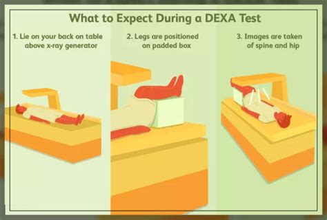 Dexa Scan Measuring Bone Density Engiomed