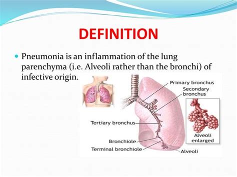 Pneumonia Introduction Pathogenesis Lab Diagnosis And Treatment Pptx