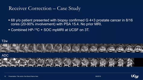 Ucsf Hyperpolarized Mr 7 3 Prostate Epsi Processing 2019 Pdf