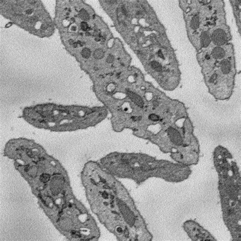 Cellsegmentation Instance Segmentation Dataset By Anl
