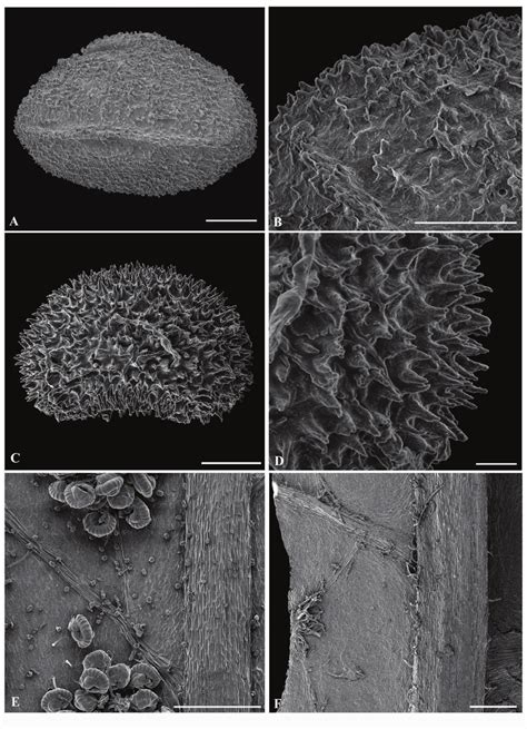 Scanning Electron Micrographs Sem Of Spores And Laminar Surface A Download Scientific
