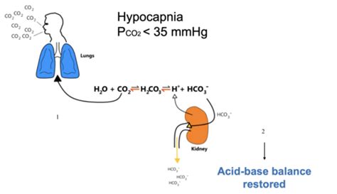 Module 12 Flashcards Quizlet Module 12 Flashcards Quizlet