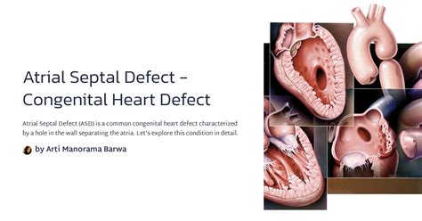 Atrial Septal Defect Congenital Heart Defect