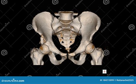 Articular Surface Stock Footage Videos Stock Videos
