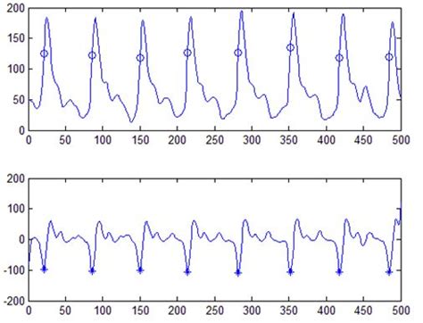A Meshfree Representation For Cardiac Medical Image Computing Ieee Journal Of Translational