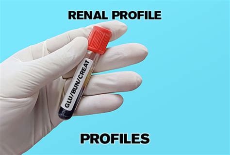 Thyroid Profile Quality Diagnostic Laboratory