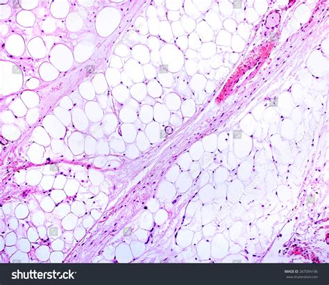Light Micrograph Of White Adipose Tissue Adipocytes Fat Cells Contain A Large Lipid Droplet