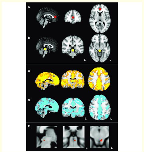 Resting State Functional Mri Analyses A And B Display Region Of Download Scientific Diagram