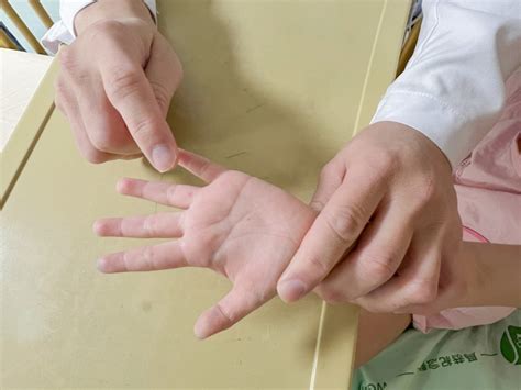 女童喉嚨痛疑似魚刺卡喉嚨 就醫診斷竟是腸病毒