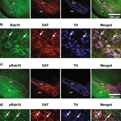 Rab10 And Prab10 Immunofluorescence And Confocal Microscopy Images In