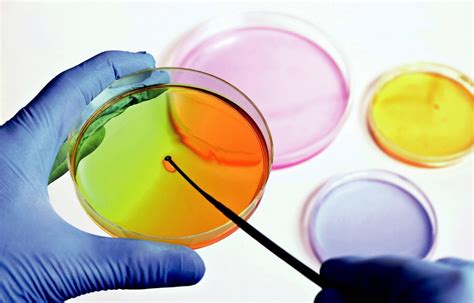 Microbios