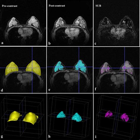 Parenchymal Enhancement