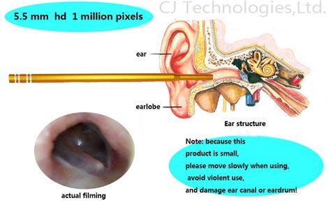 What Does The Ear Drum Look Like On Camera