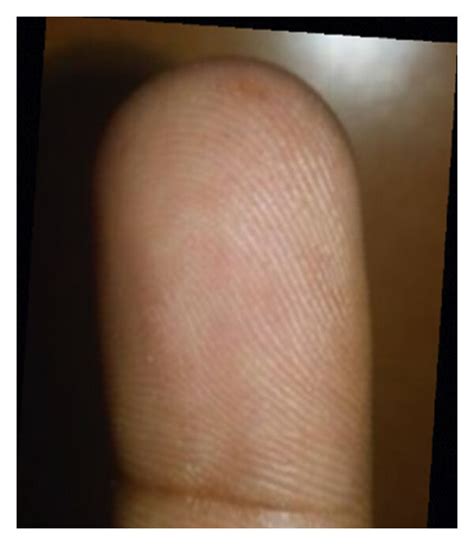 Stages Of Rotation Alignment A Reference Intensity Image B Input