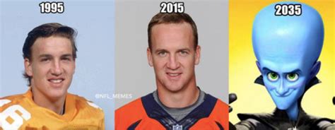Peyton Manning Forehead Before And After