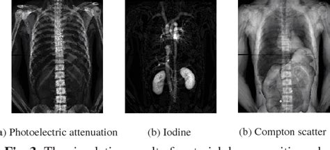 Figure 1 From A Novel Material Decomposition Algorithm For Multienergy X Ray Radiography Systems