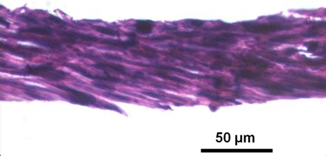 Thick Multilayered Tissue Constructs Were Formed With Aligned Download Scientific Diagram