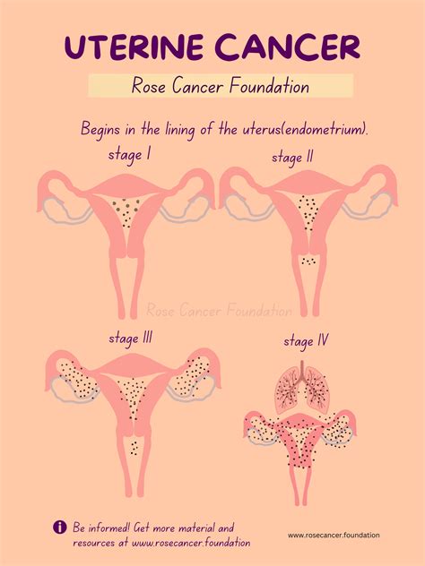 Uterineendometrial Cancer