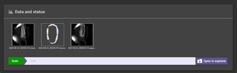 3shape Automate Exocad Order Workflow 3shape Design Services